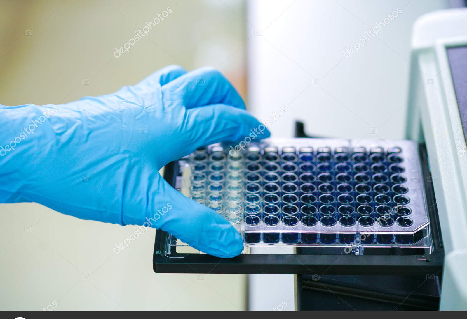 ELISA: The 4 important Types of ELISA for Diagnosis of Diseases | The ...