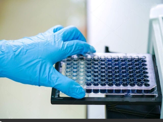 ELISA: The 4 important Types of ELISA for Diagnosis of Diseases | The ...